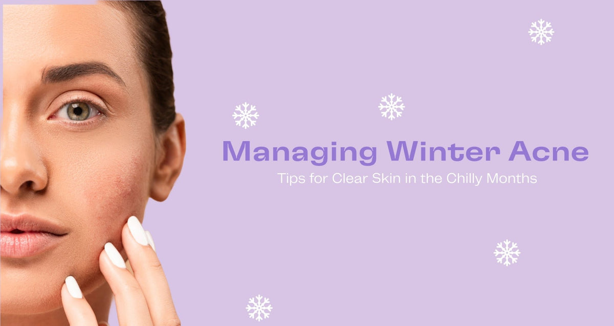 Winter Acne - Tips To Prevent Winter Acne